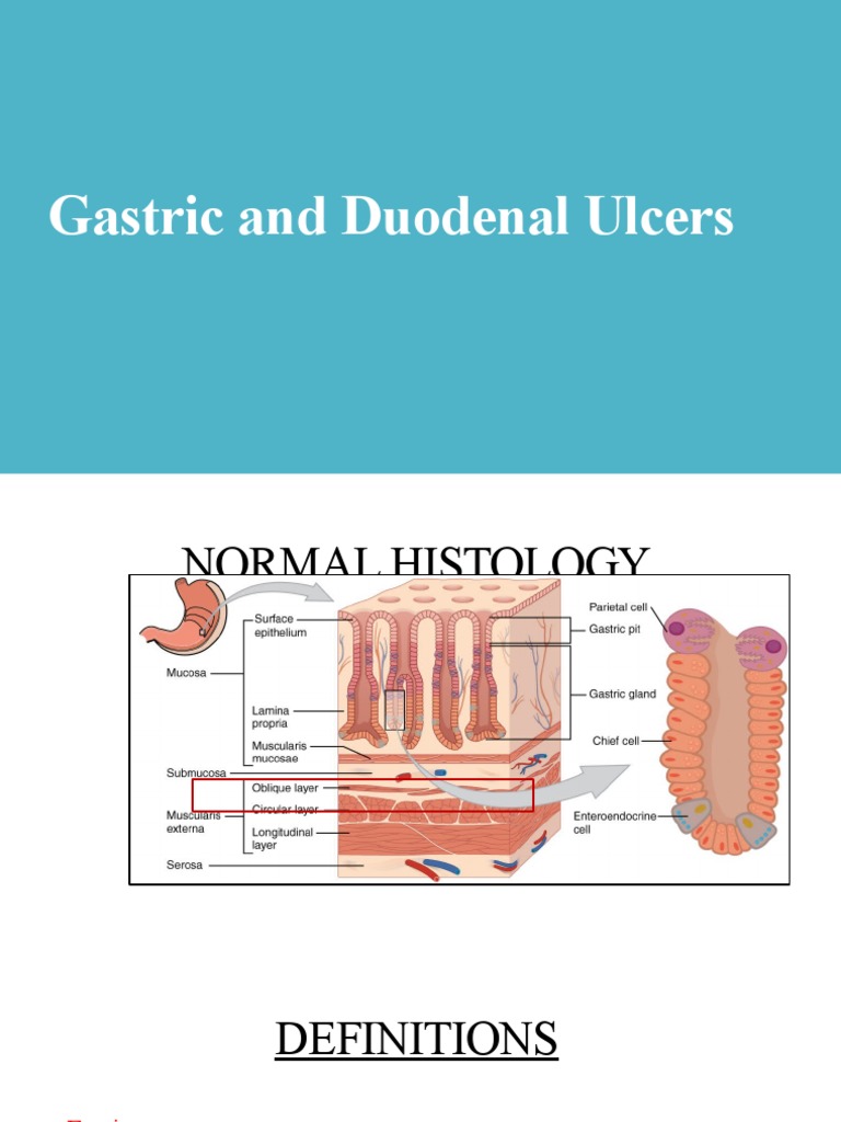 Gastric and Duodenal Ulcer | PDF | Stomach | Cancer