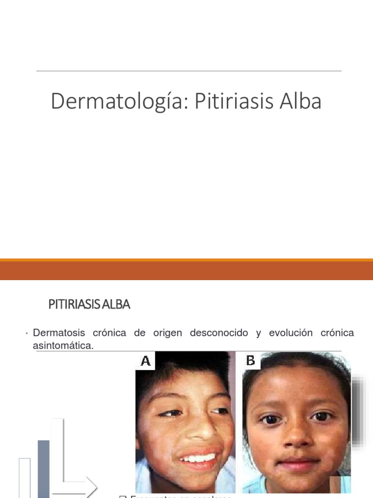 Pitiriasis Alba | PDF | Medicina CLINICA | Ciencias de la Salud