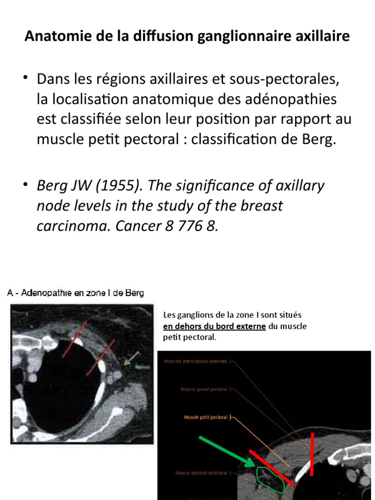 Ganglions Axillaires Photos _ Ganglions Axillaires De L’Aisselle – KYDS