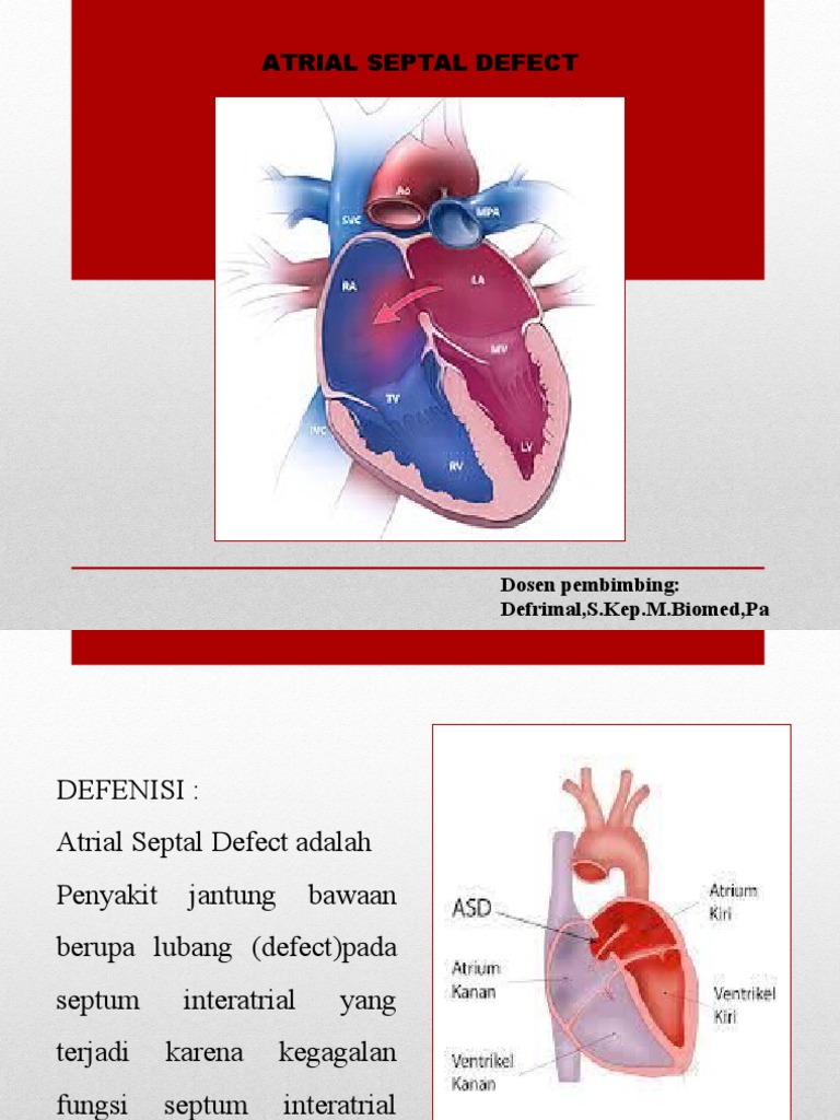 Definisi dan Patofisiologi ASD Jantung | PDF | Sains & Matematika