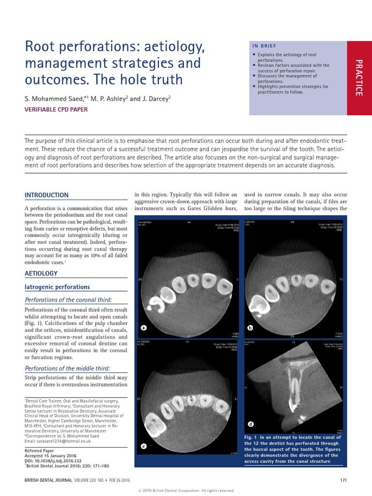 Root Perforations: Aetiology, Management Strategies and Outcomes. The ...
