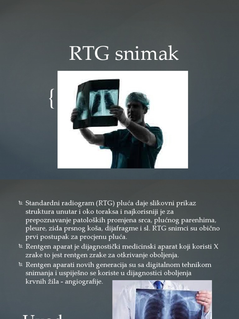 RTG Snimak | PDF