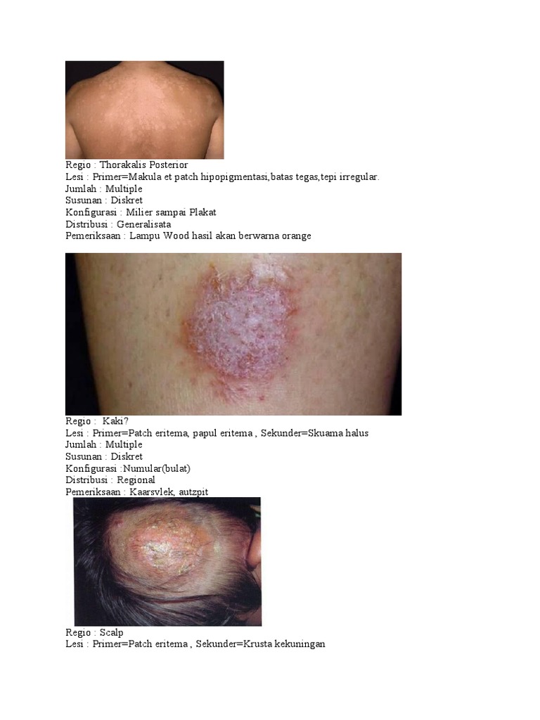 Lesi Kulit OSCE | PDF