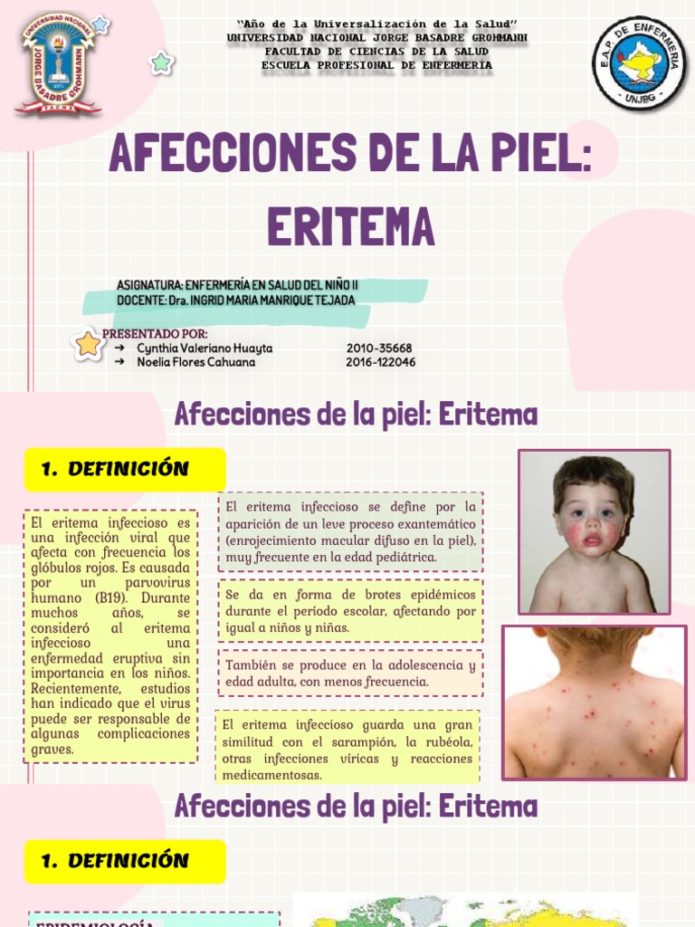 Tratamiento del Eritema Infeccioso | PDF