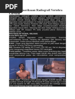 Teknik Pemeriksaan Lumbosacral SK071 | PDF