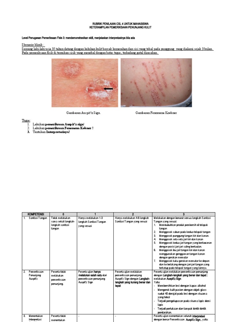 Pemeriksaan Koebner Sign pada Kulit | PDF