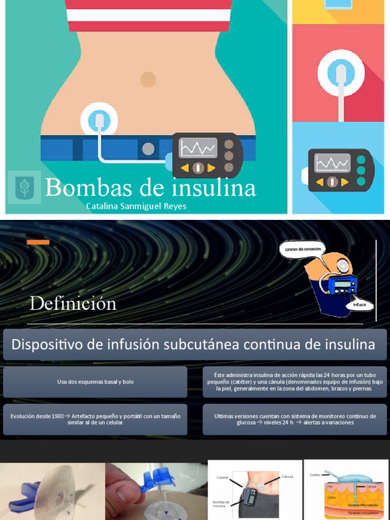 Bombas de Insulina | PDF | Hipoglucemia | Diabetes