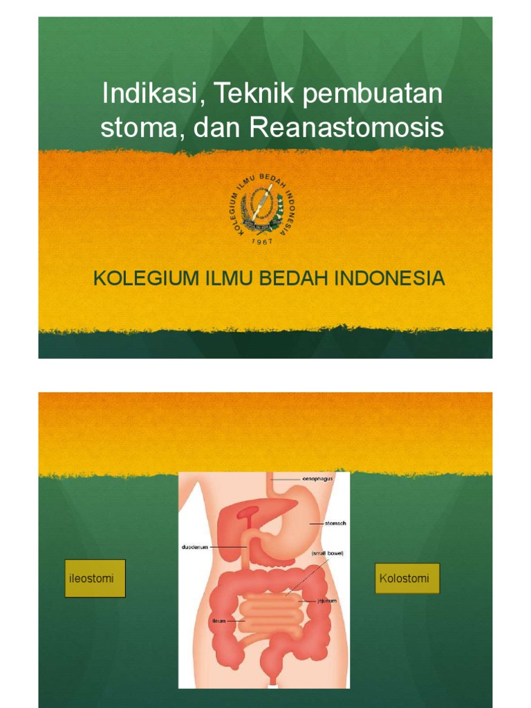 Stoma Creation and Reanastomosis Techniques | PDF | Colorectal Cancer ...