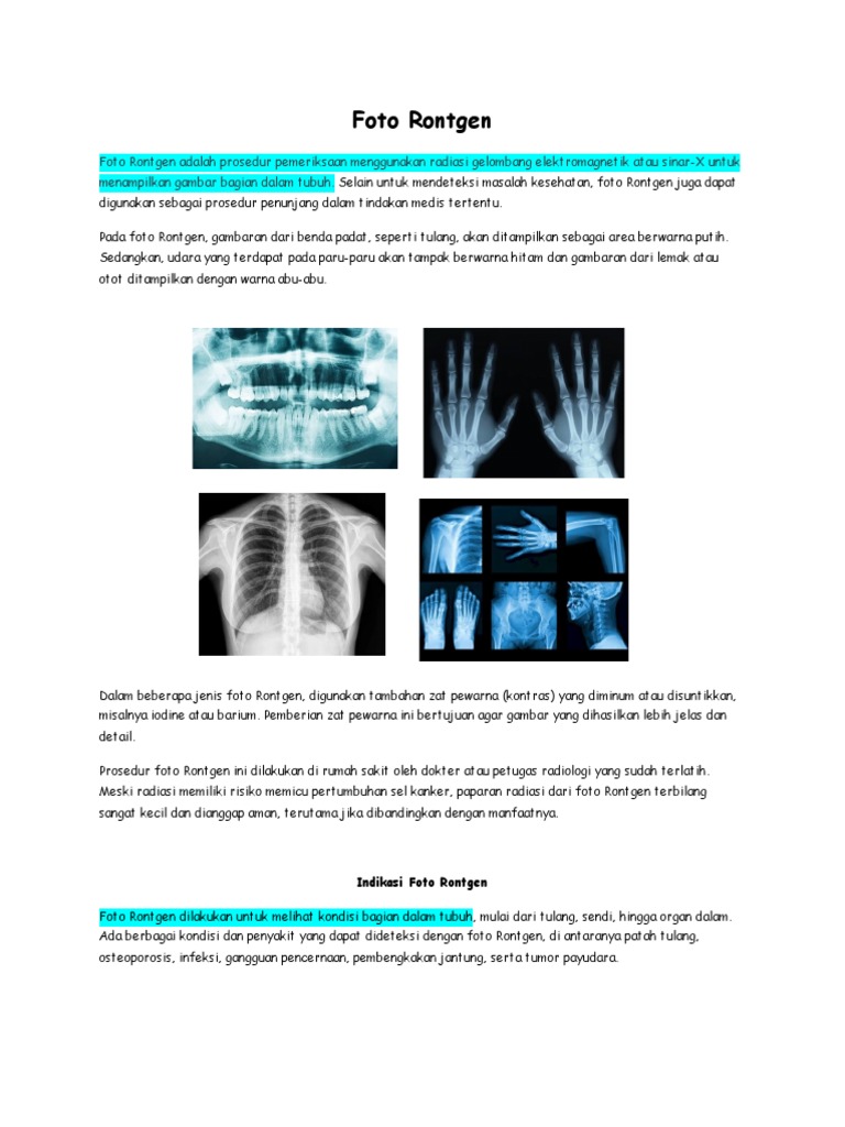 Foto Rontgen | PDF