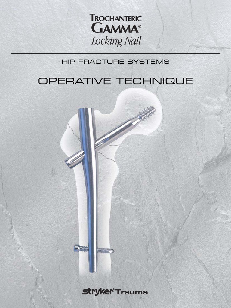 Gamma - TGN - OpTech - 060603 Ver4 | PDF | Screw | Hip