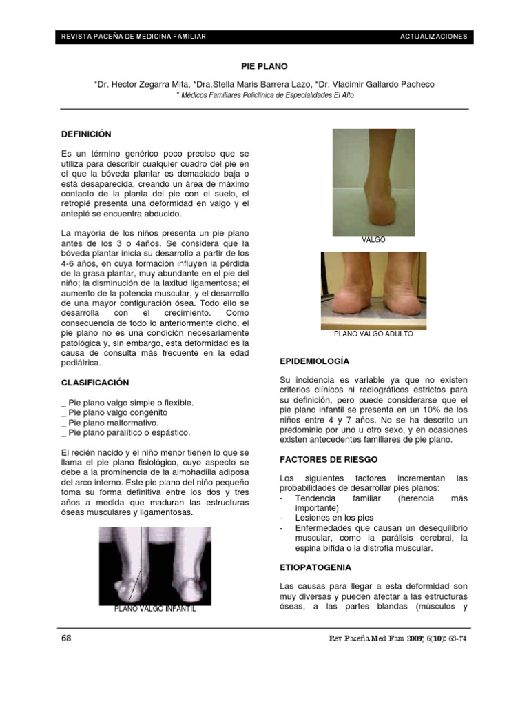Pie plano: clasificación, factores de riesgo y evaluación | PDF | Pie ...