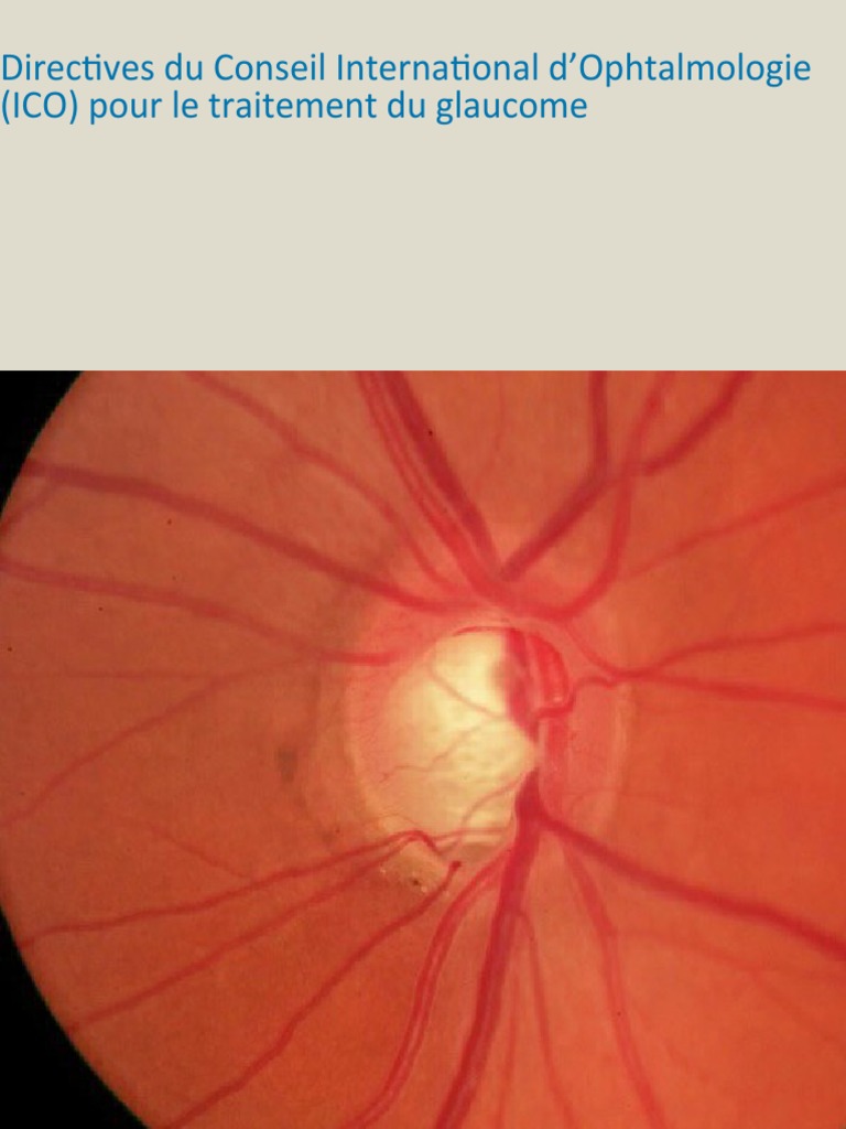ICOGlaucomaGuidelines French | PDF | Glaucome | Ophtalmologie