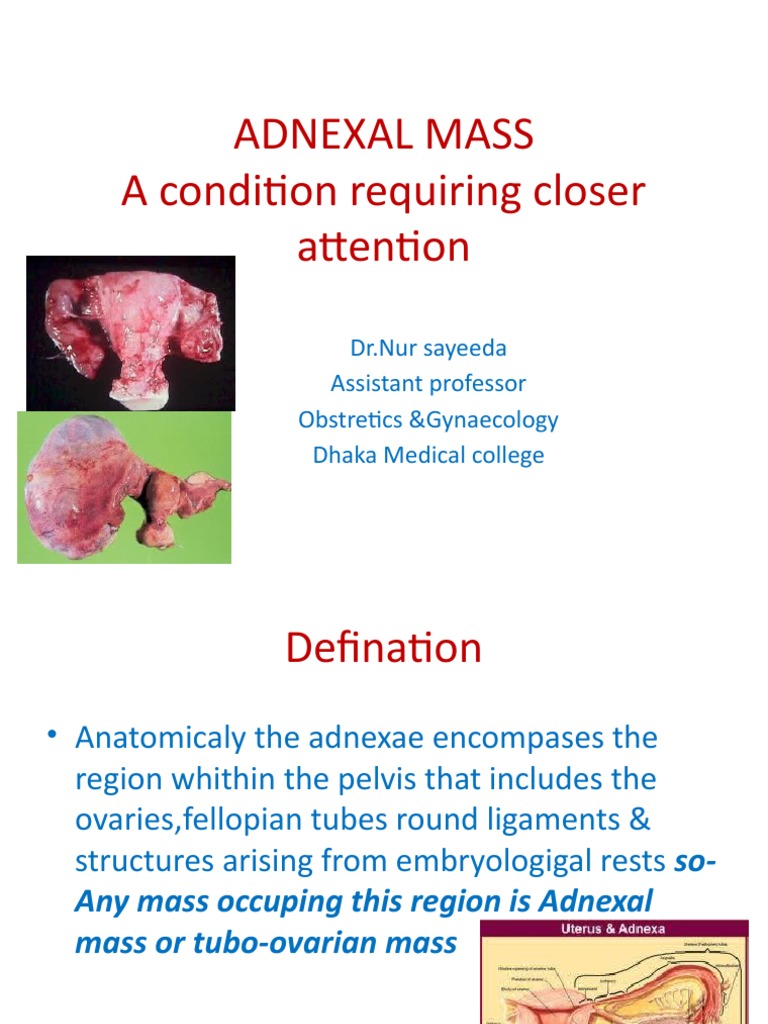 Adnexal Mass A Condition Requiring Closer Attention | PDF | Ovarian ...