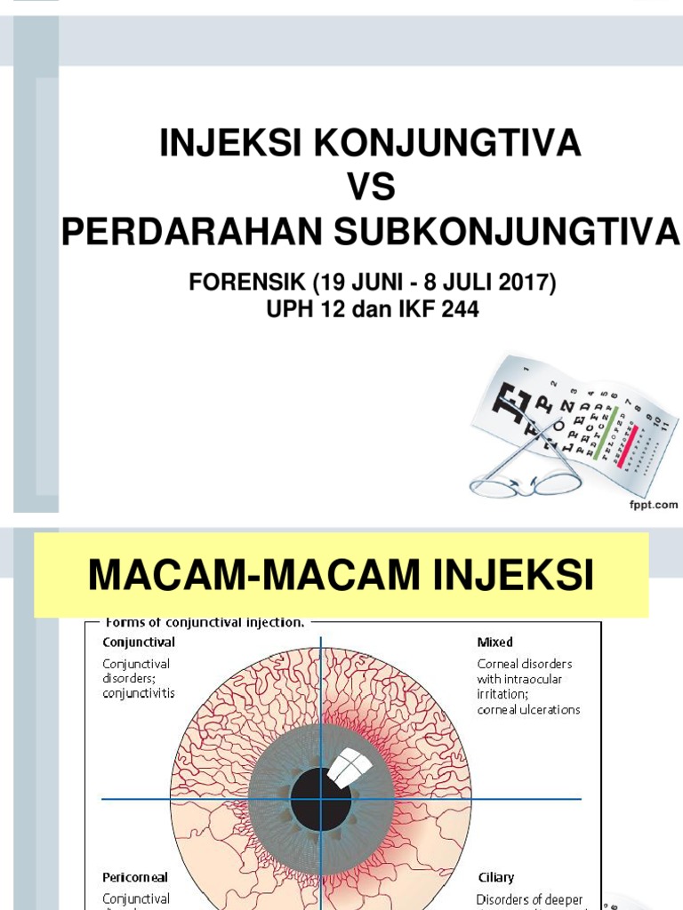 Injeksi Konjungtiva Vs Perdarahan Subkonjungtiva | PDF