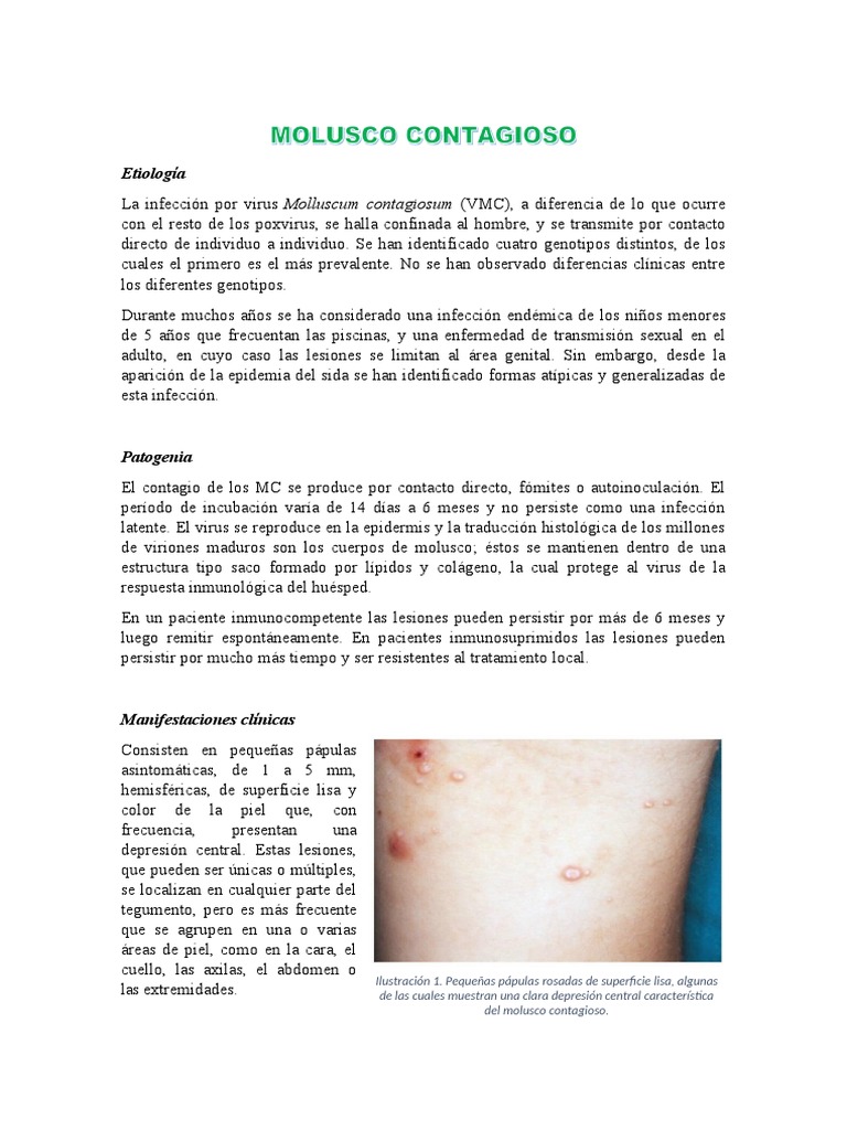 Molusco Contagioso | PDF | Medicina CLINICA | Inmunología