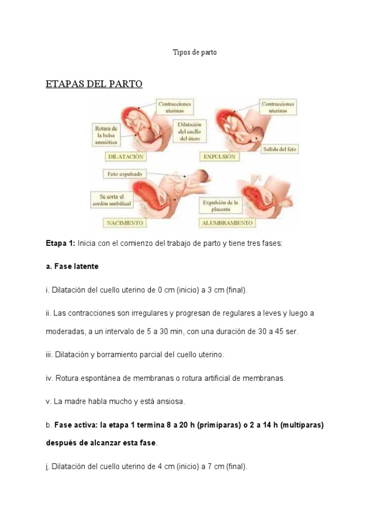 Tipos de Parto | PDF | Parto | Seccion de cesárea