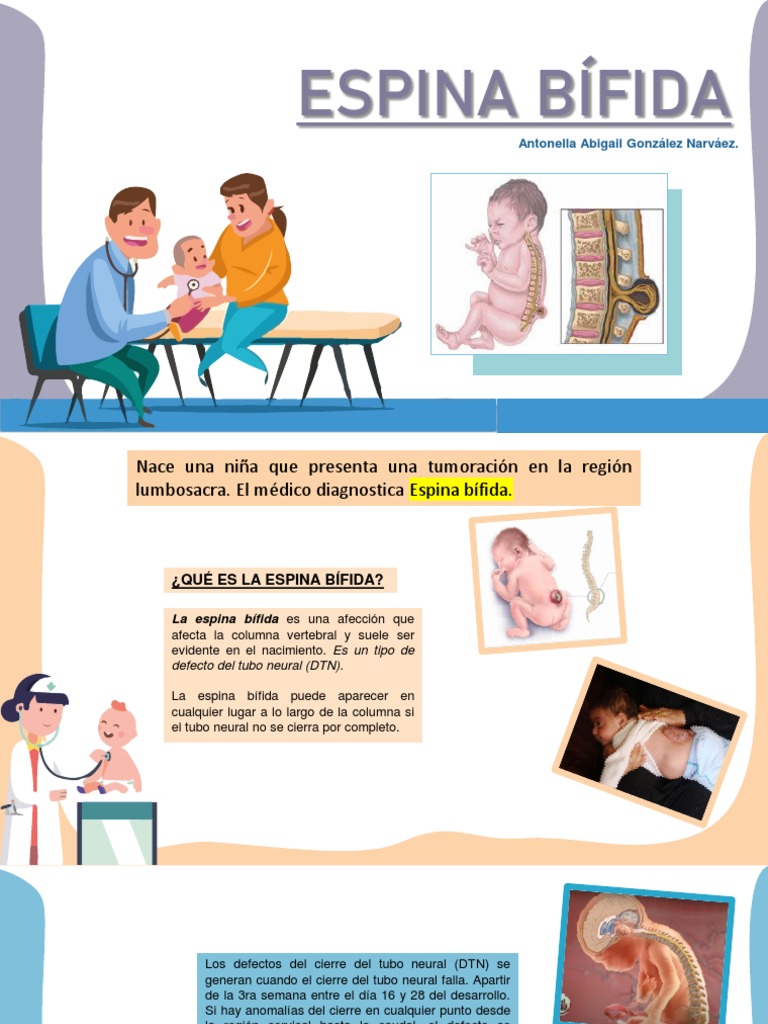 DTN Espina Bifida | PDF | Sistema nervioso | Anatomía