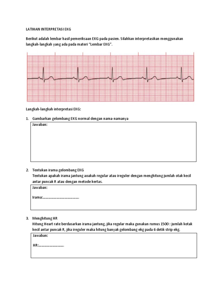 Latihan Ekg | PDF