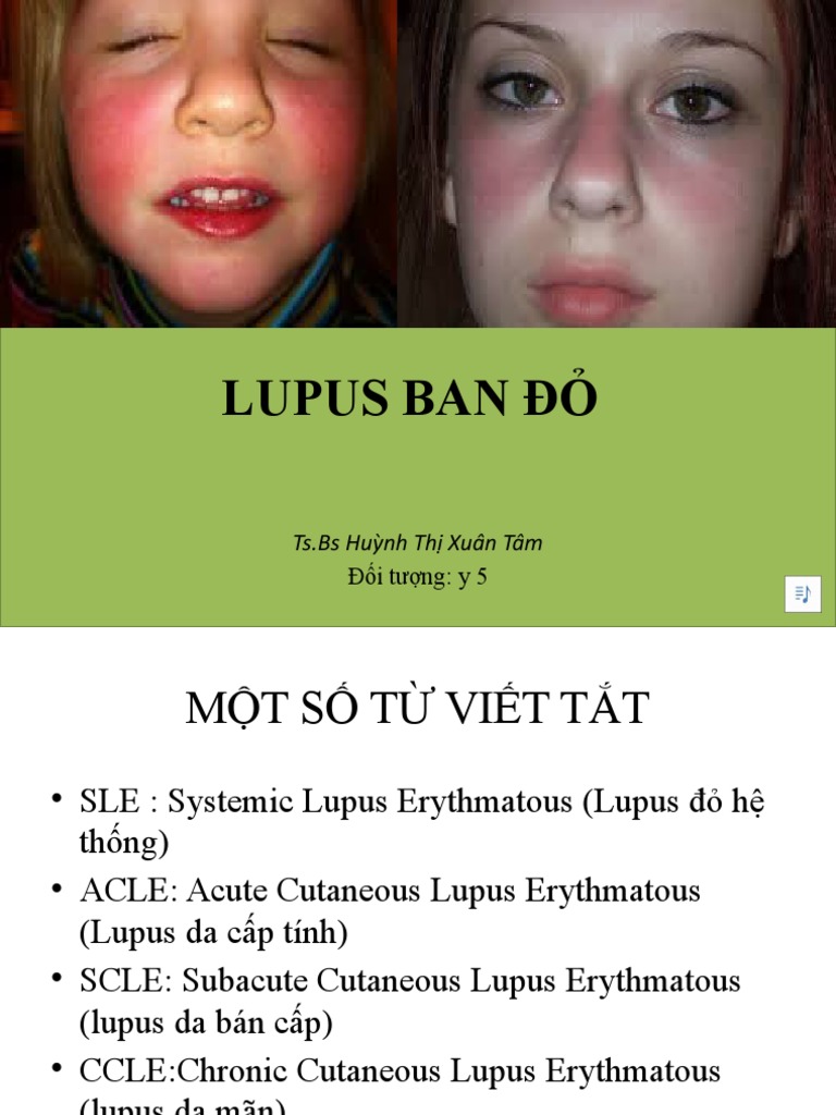 3.1 Lupus ban đỏ | PDF