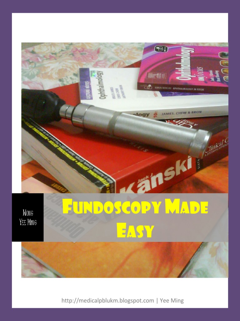 Fundoscopy Made Easy Ming 2009 | PDF | Retina | Eye
