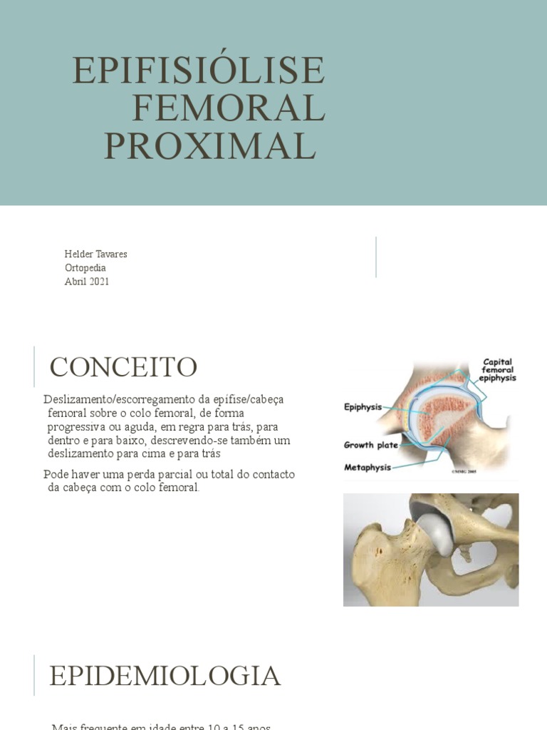 Epifisiólise Femoral Proximal | PDF | Imagiologia médica | Imagem de ...