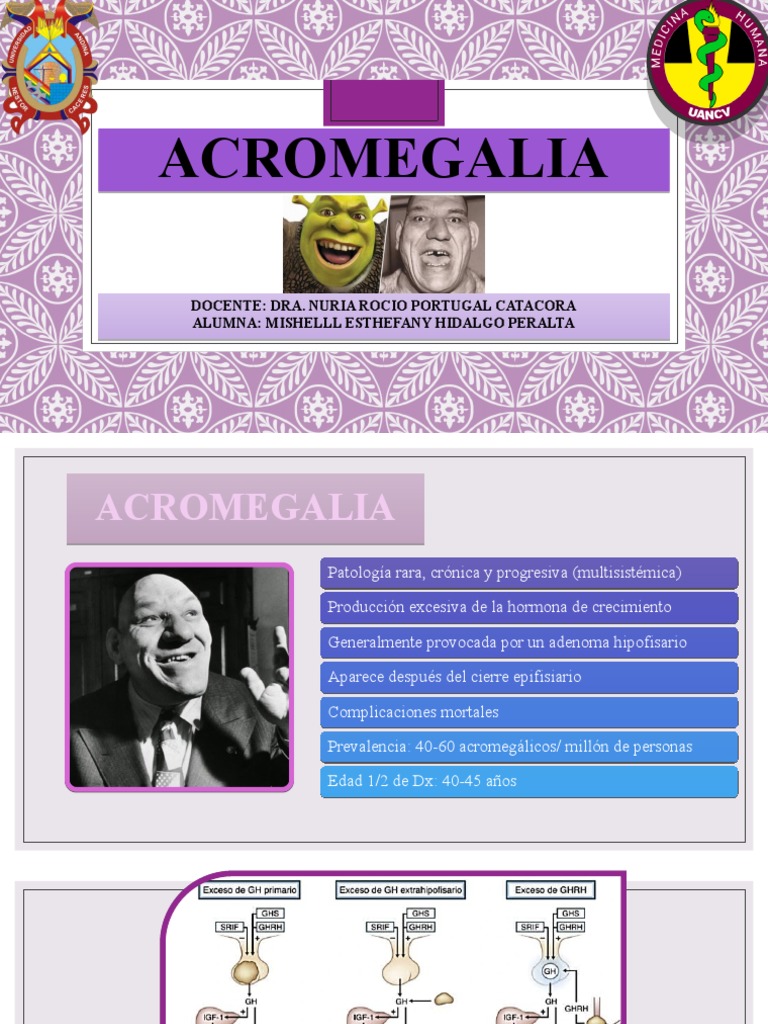 ACROMEGALIA | PDF