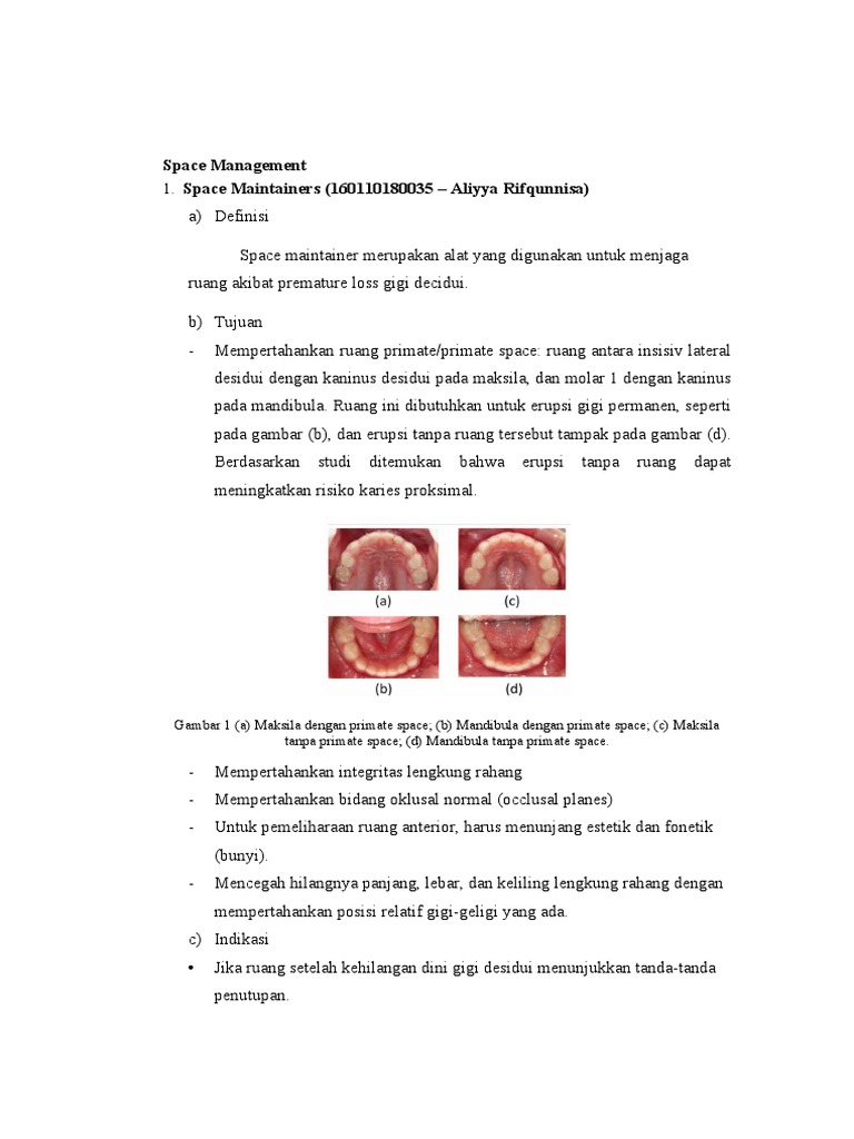 Space Maintainers | PDF