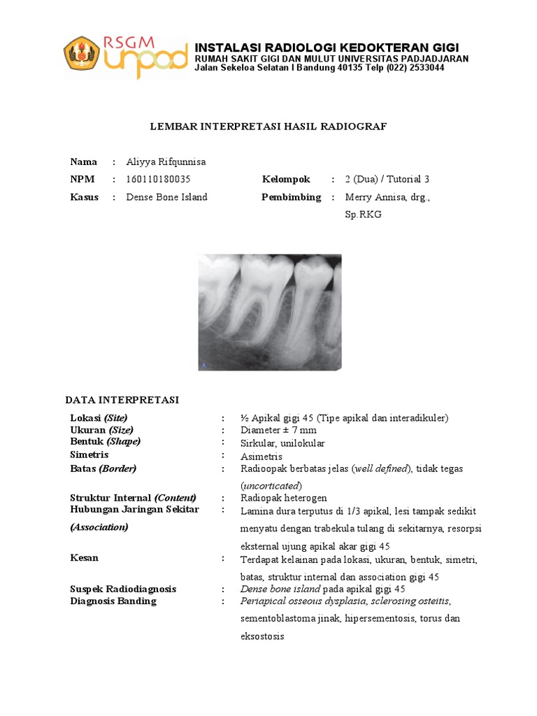 Interpretasi Dense Bone Island - 160110180035 - Aliyya Rifqunnisa | PDF