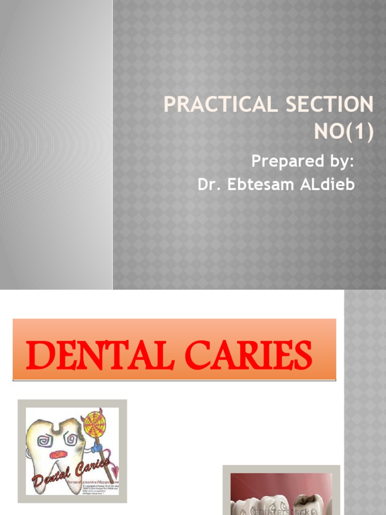 Practical of Dental Caries (2017) | PDF | Tooth Enamel | Dentin