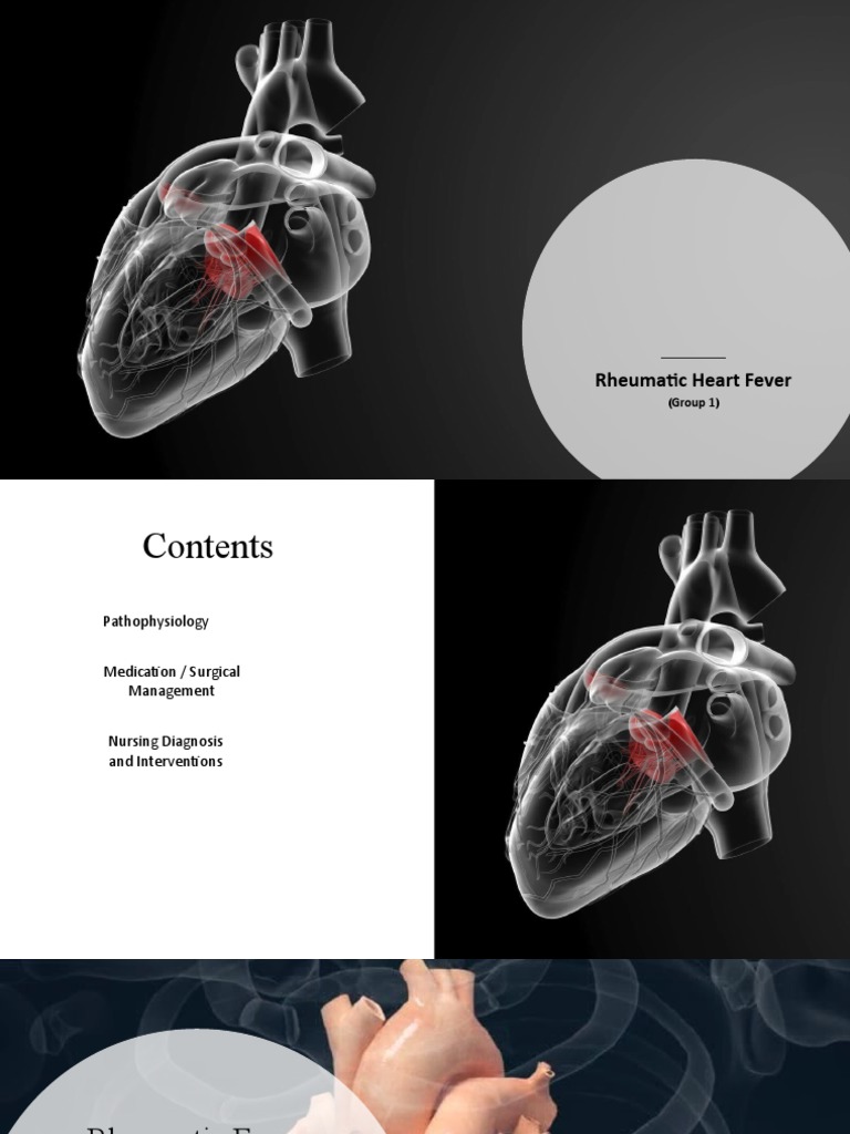 Pathophysiology, Management, and Nursing Care of Rheumatic Heart ...