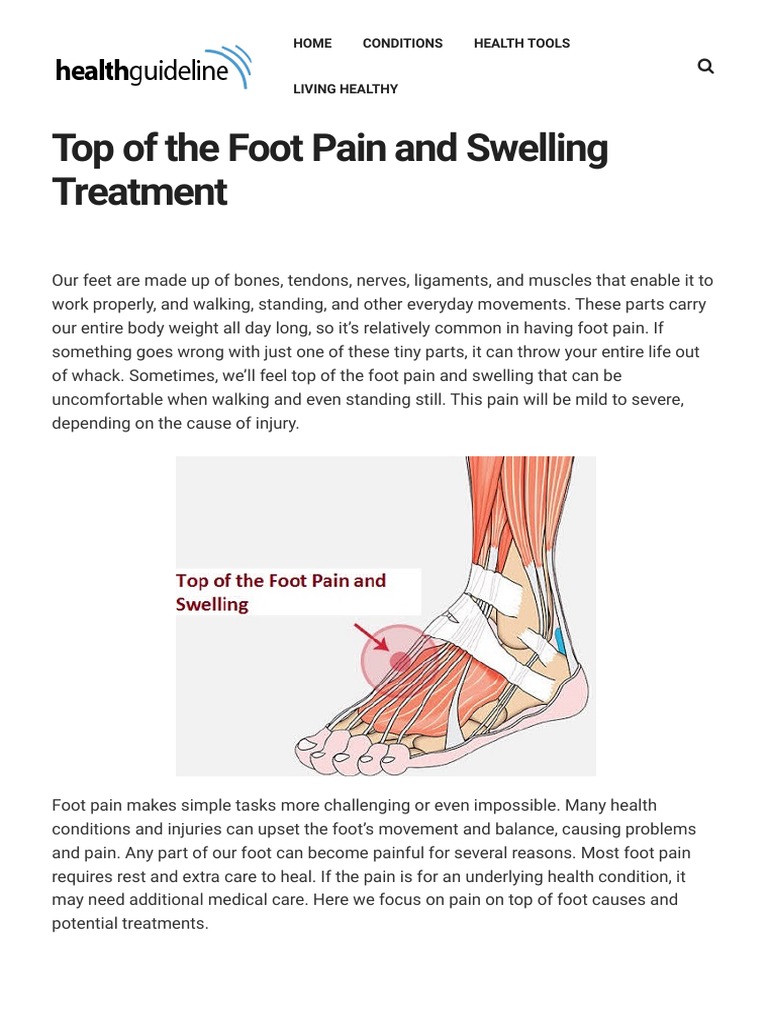 Top Of Foot Sprain Treatment _ Sprained Foot Injury – EXBEO