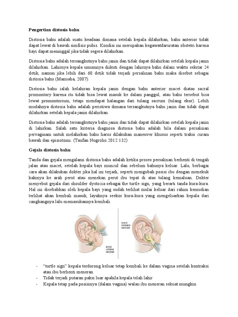 Tanda dan Penanganan Distosia Bahu | PDF | Sains & Matematika
