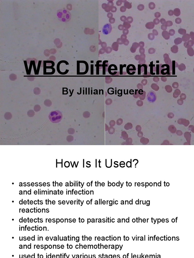 WBC Differential Presentation | PDF | White Blood Cell | Granulocyte