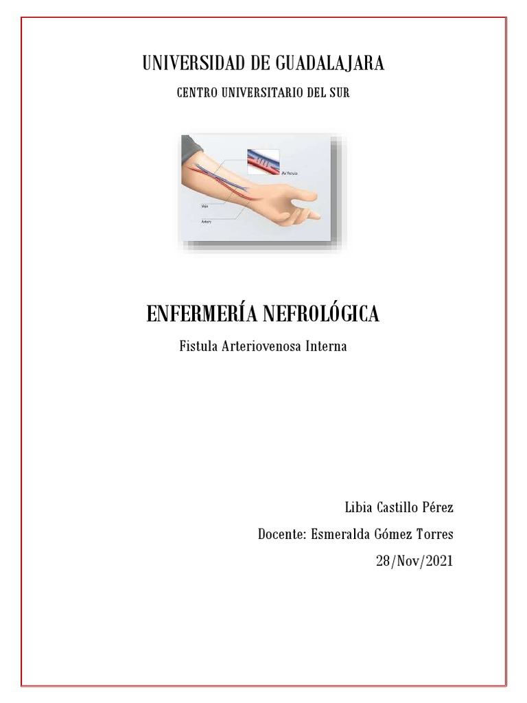 FAVI | PDF | Hemodiálisis | Especialidades Medicas