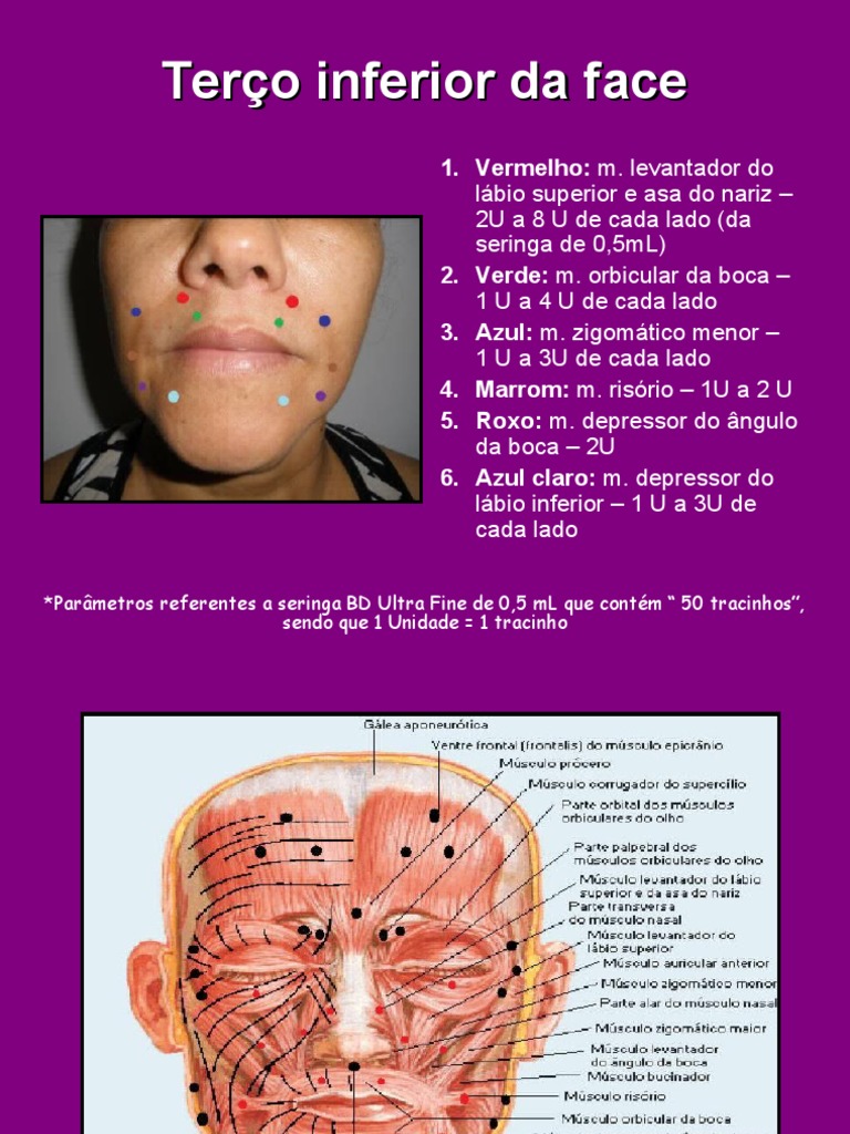 Pontos de Botox Face | PDF | Anatomia humana | Especialidades médicas