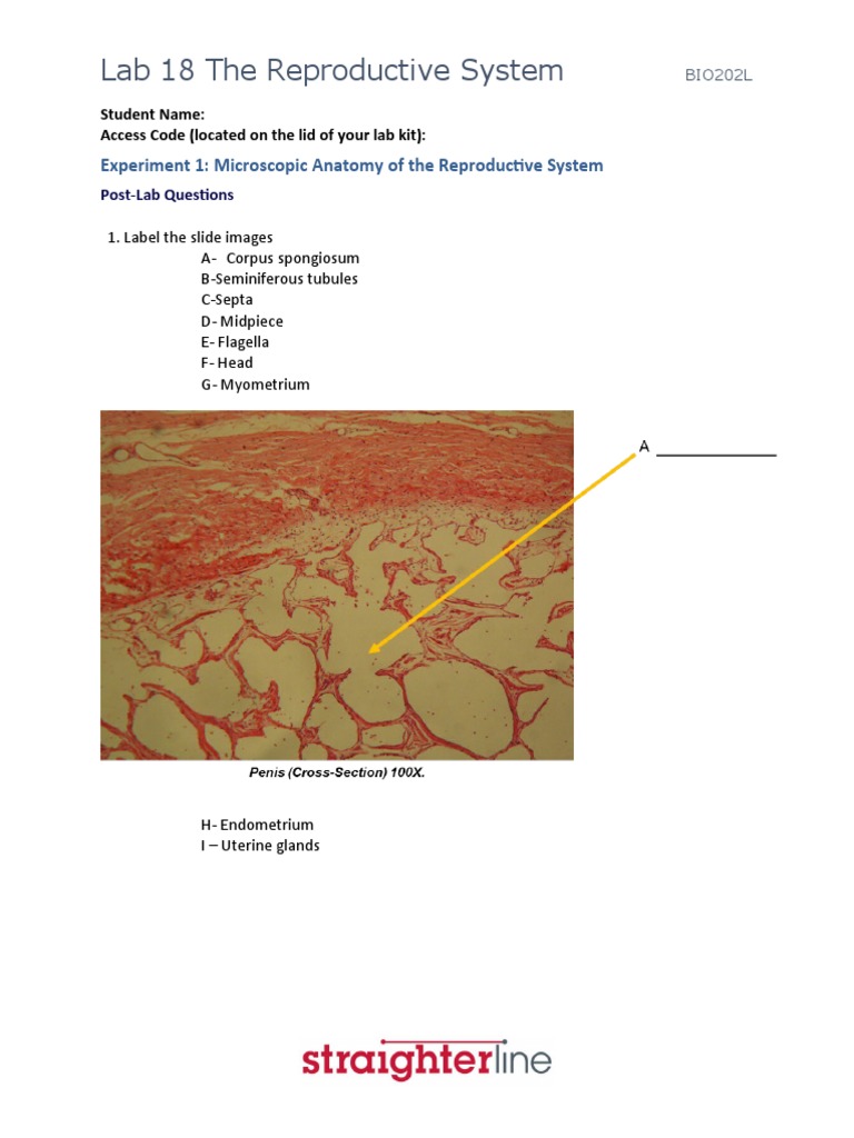 Lab 18: Reproductive System Overview | PDF | Reproductive System | Uterus