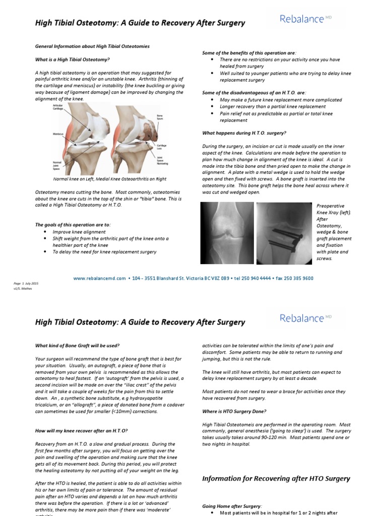 High Tibial Osteotomy: A Guide To Recovery After Surgery | PDF | Knee ...