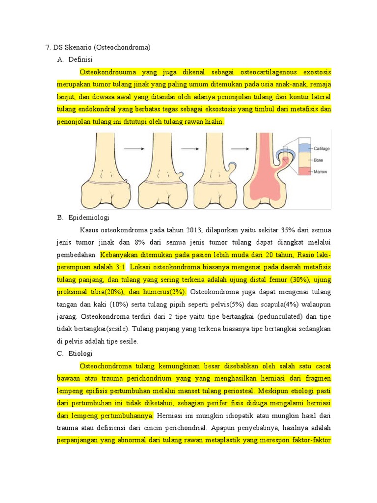 Osteochondroma: Panduan Medis | PDF