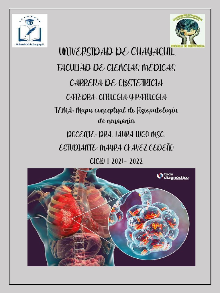 Mapa de Neumonia | PDF | Neumonía | Medicina