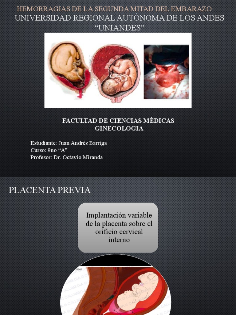 Juan Andrés Barriga - Hemorragias Del Segundo Trimestre | PDF | El ...