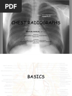 Chest X-Ray Template | PDF | Lung | Thorax