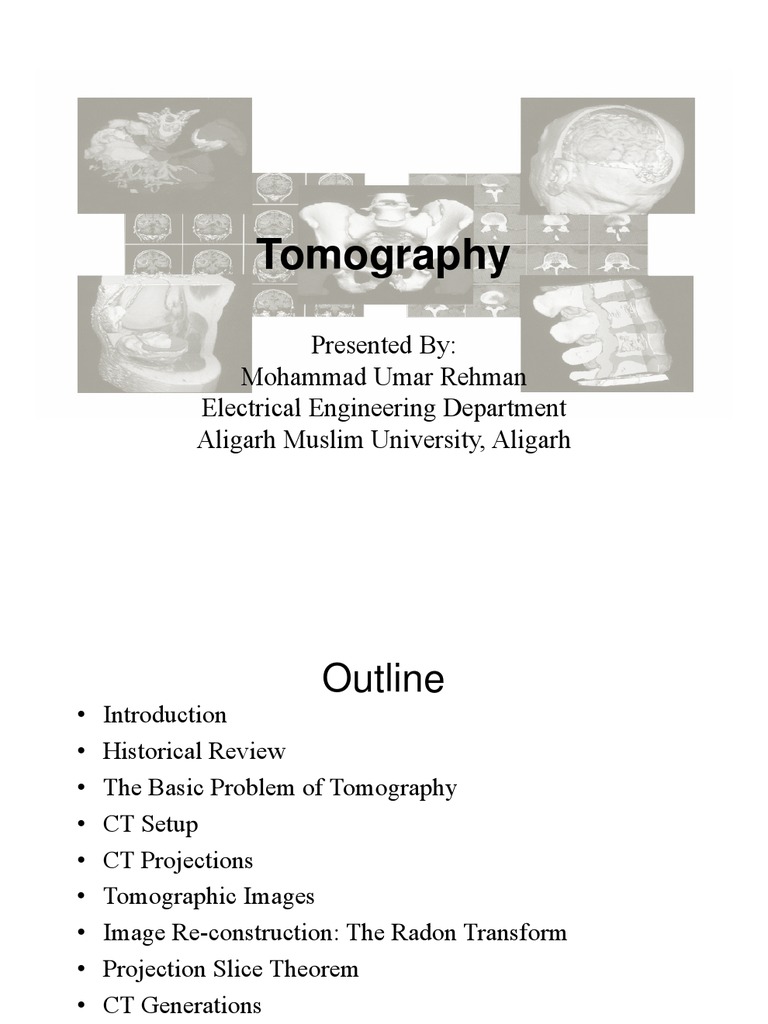 Tomography Tomography | PDF | Tomography | Ct Scan