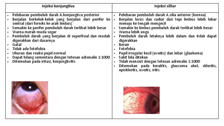 Skillslab Mata (Injeksi Silliar Dan Konjungtiva) | PDF