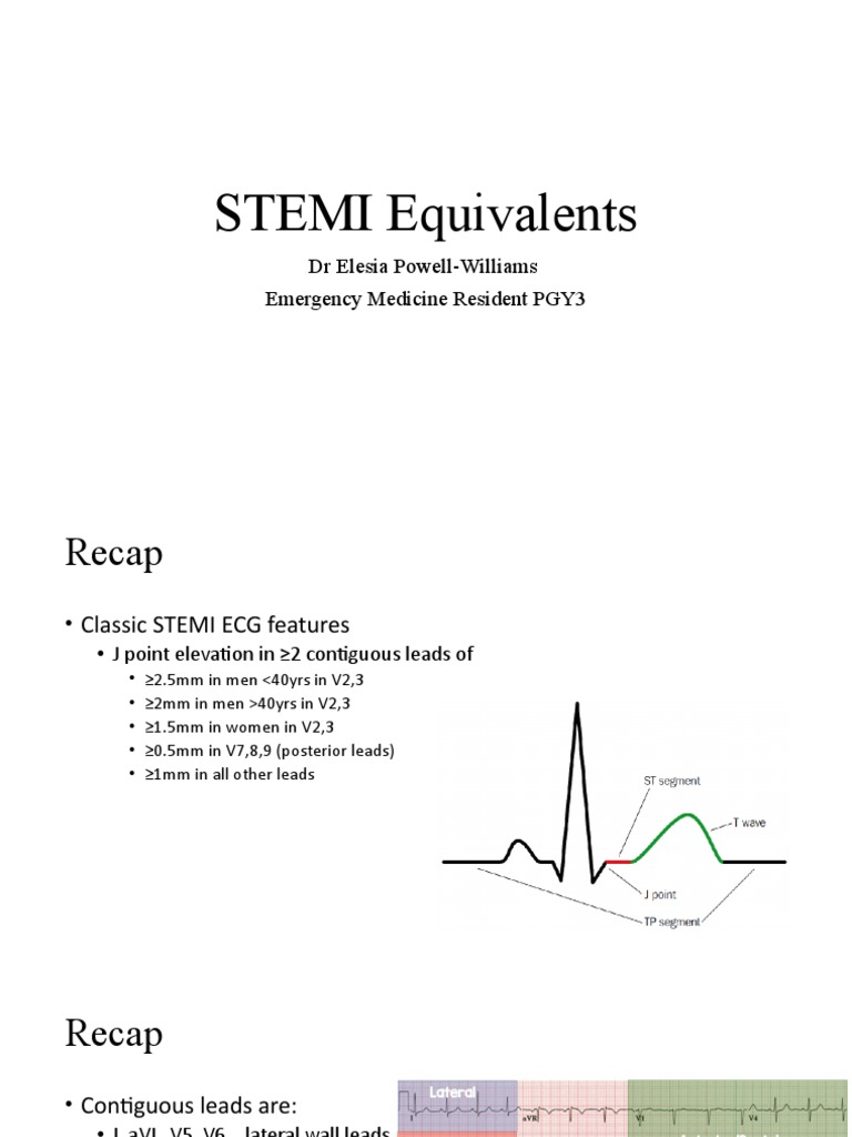 STEMI Equivalents: DR Elesia Powell-Williams Emergency Medicine ...
