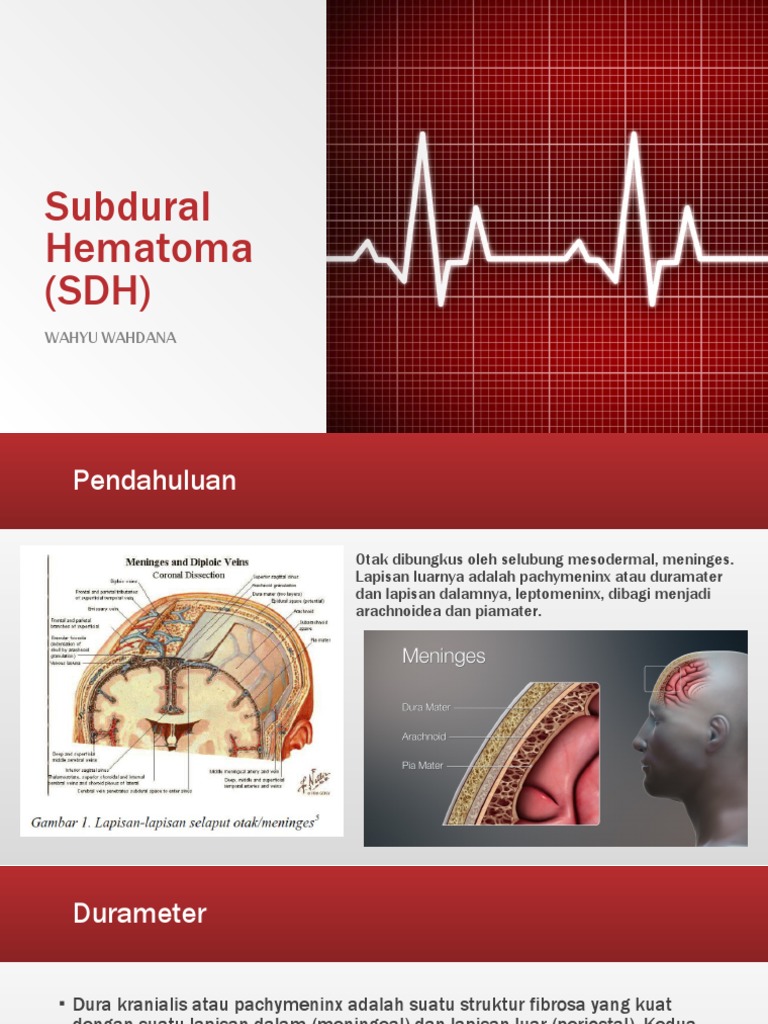 Askan Neurologi - Pengertian, Anatomi Fis SDH, Bagian Lobus2, Saraf2, Penyebab SDH, Patofis ...