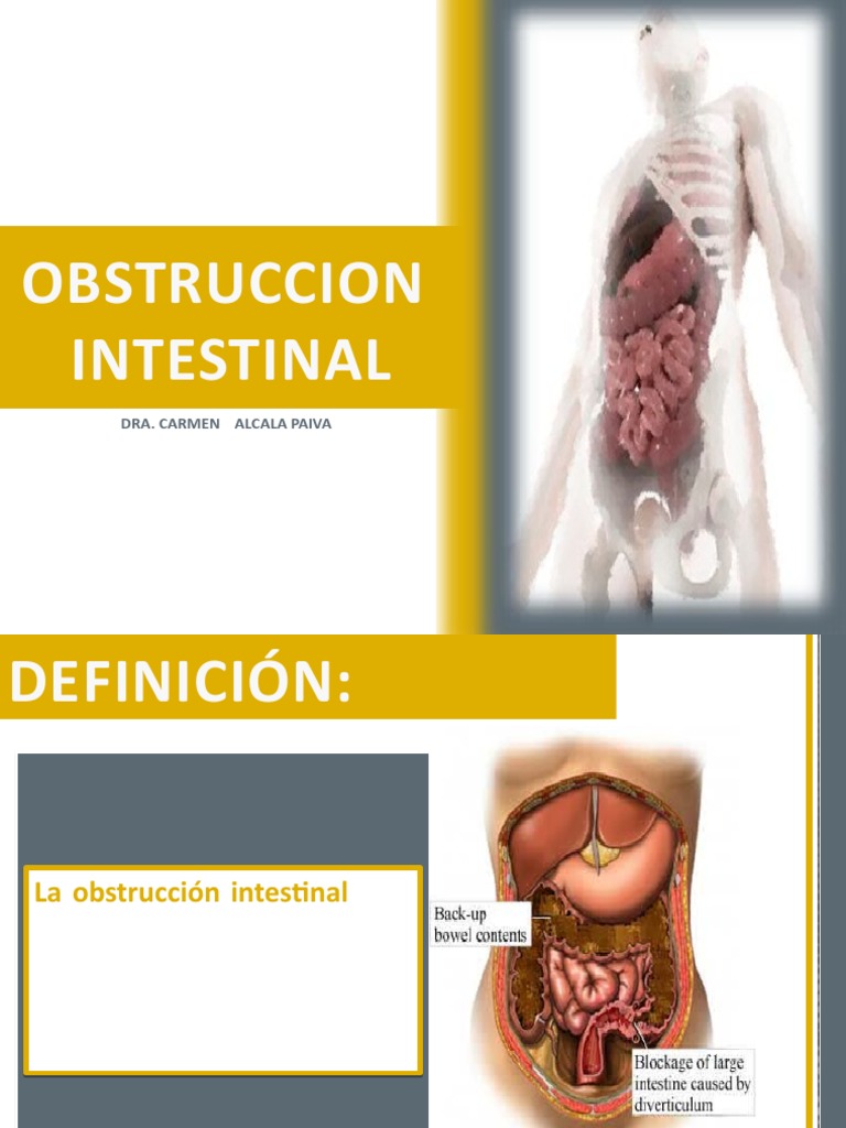 Obstrucción intestinal: causas, clasificación, fisiopatología y ...