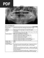 Anatomi Maksila & Mandibula | PDF
