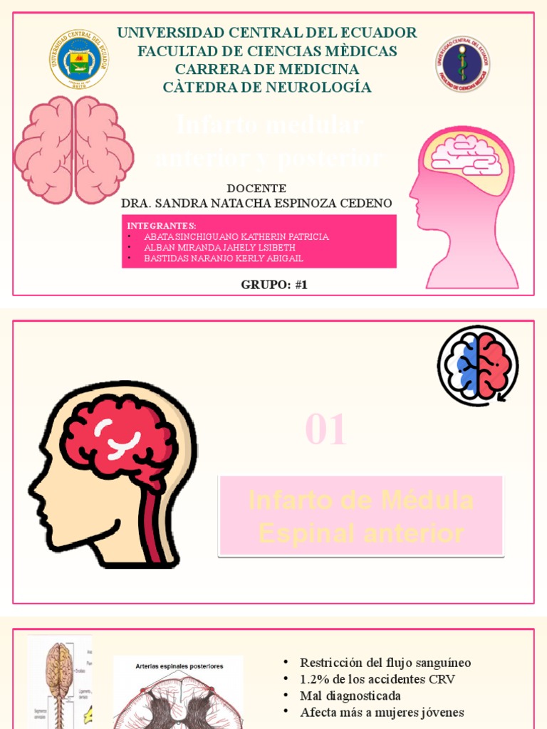 Infartos de Medula Espinal Anterior y Posterior | PDF | Infarto de ...