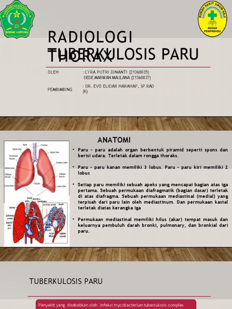 Radiologi Tuberkulosis Paru: Diagnosis dan Gambar | PDF