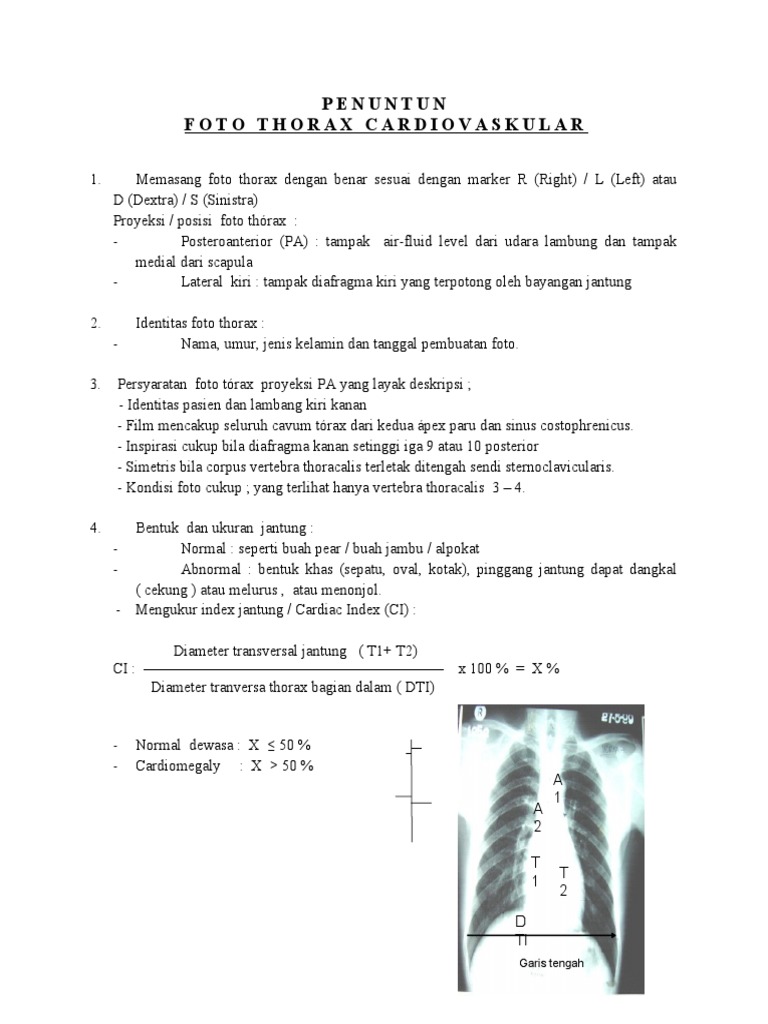Rontgen Kardiak | PDF